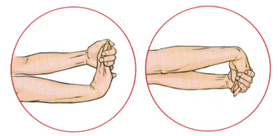 Tennis Elbow-exercise